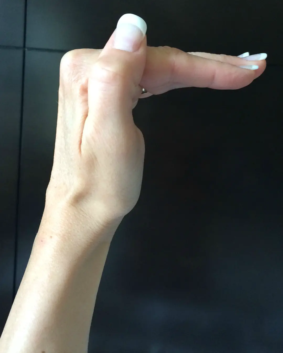 Relaxation for Repetitive Strain Injury of the Wrists